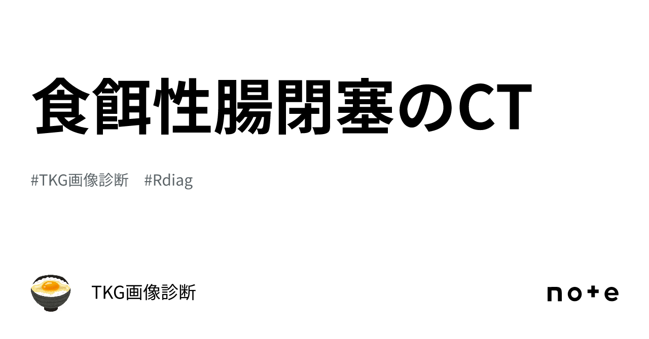 食餌性腸閉塞のCT｜TKG画像診断