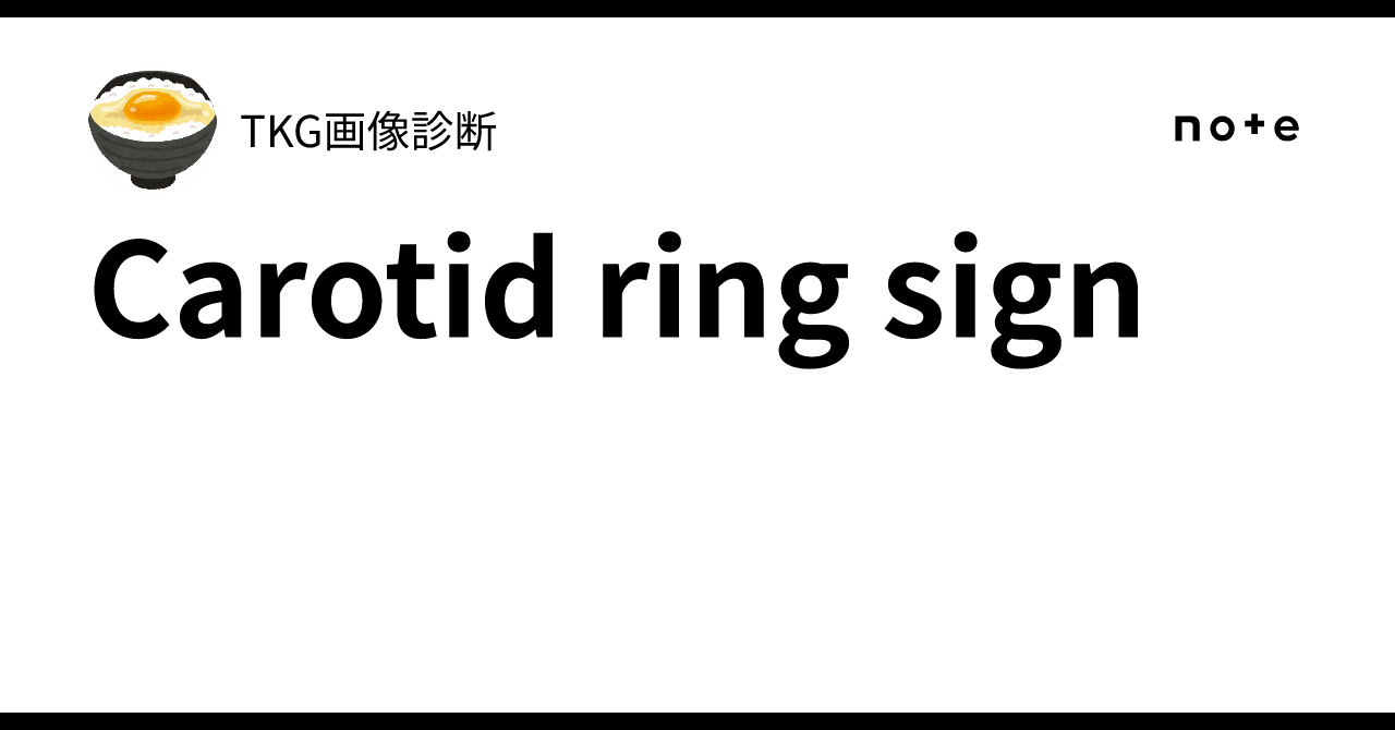 Carotid ring sign｜TKG画像診断