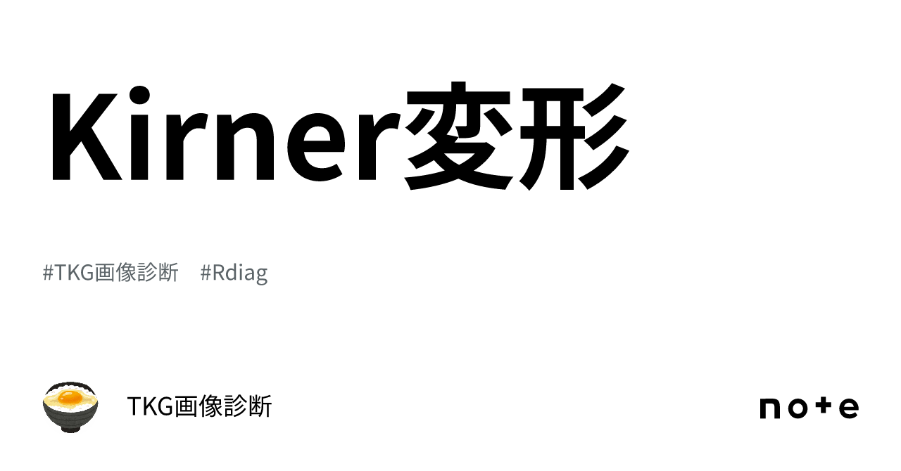 Kirner変形｜TKG画像診断