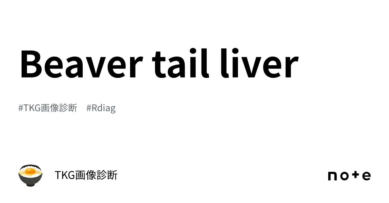 Beaver tail liver｜TKG画像診断