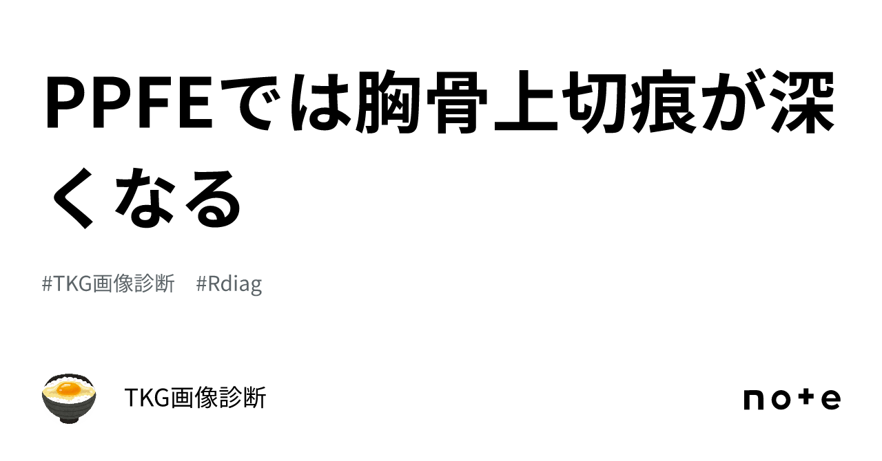 PPFEでは胸骨上切痕が深くなる｜TKG画像診断
