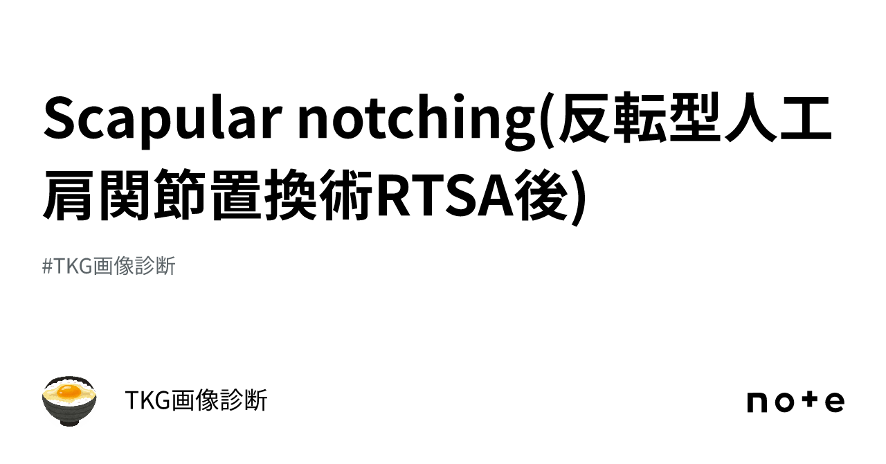 Scapular notching(反転型人工肩関節置換術RTSA後)｜TKG画像診断